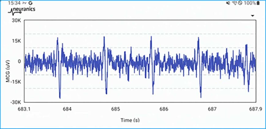 Neuranics monitora il cuore con sensori magnetici - macitynet.it